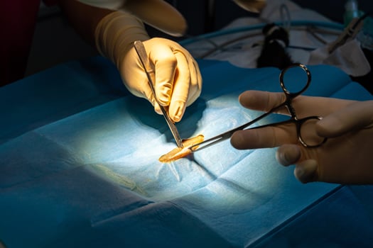 How Do You Care for an Incision After Microdiscectomy?