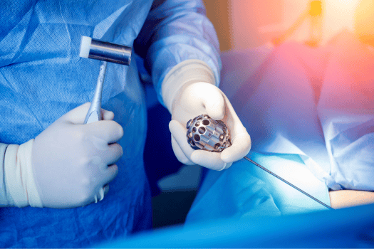 Is Microdiscectomy a Day Surgery?