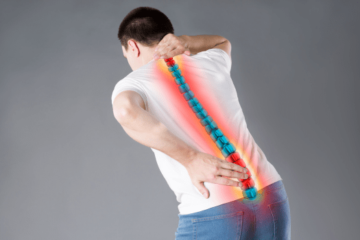 What Does Reherniation Feel Like?