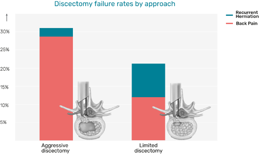 Discectomy 101: The Risks and Results to Understand Before Your Spine ...