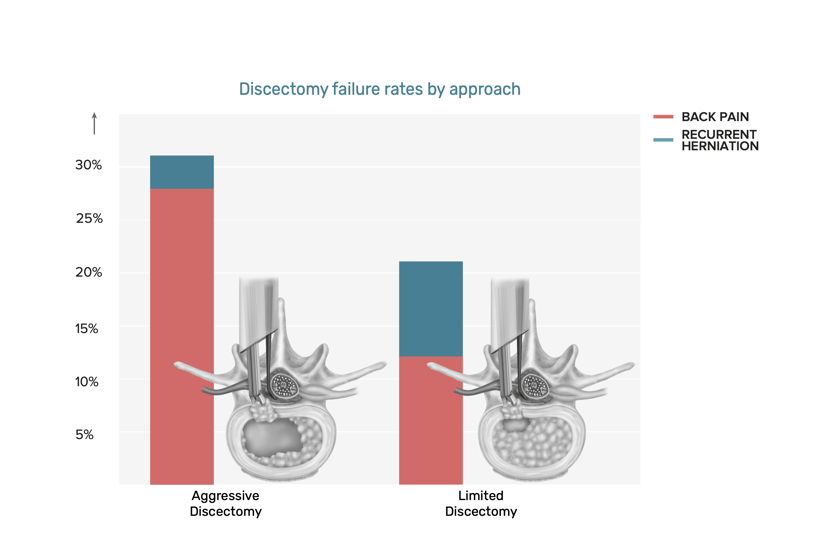 Surgery for Sciatica: Which Procedure Is Right for You?